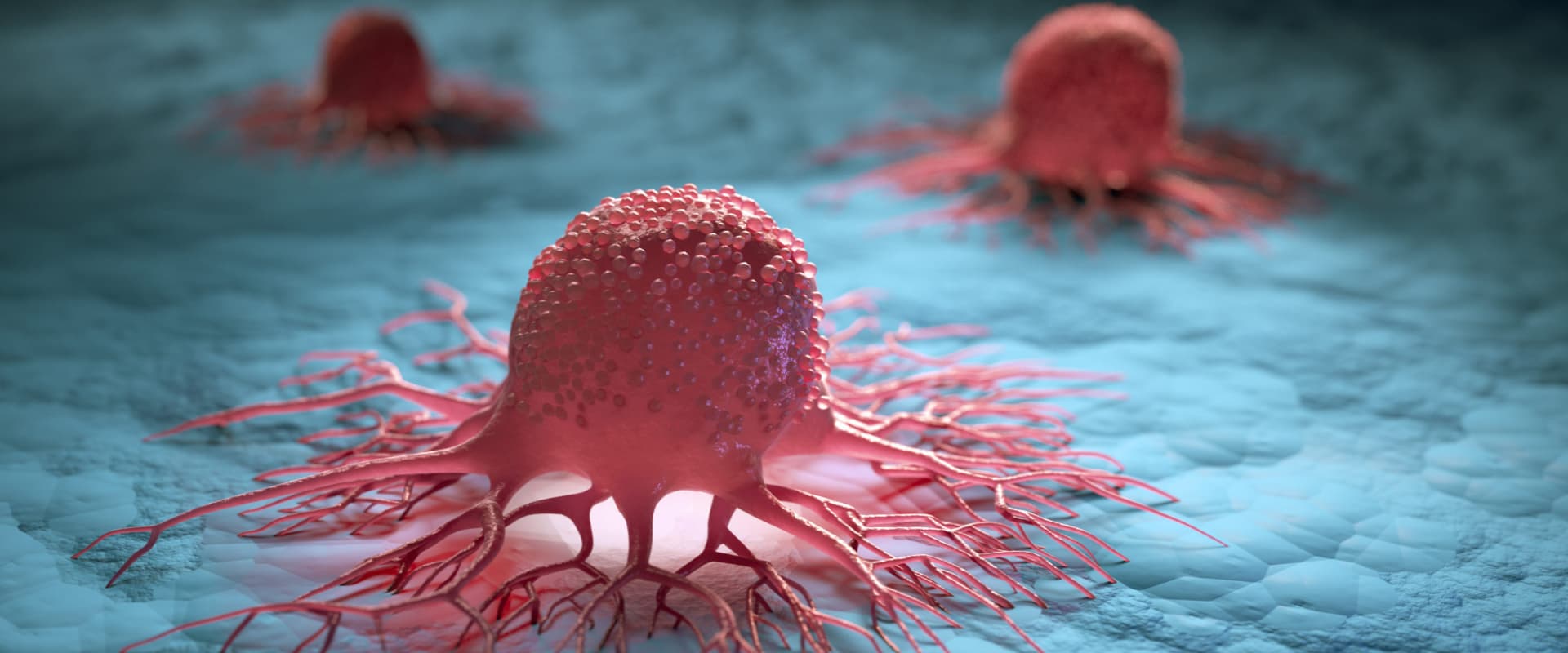 Prueba del Virus de Epstein-Barr - Servicio de Infectología